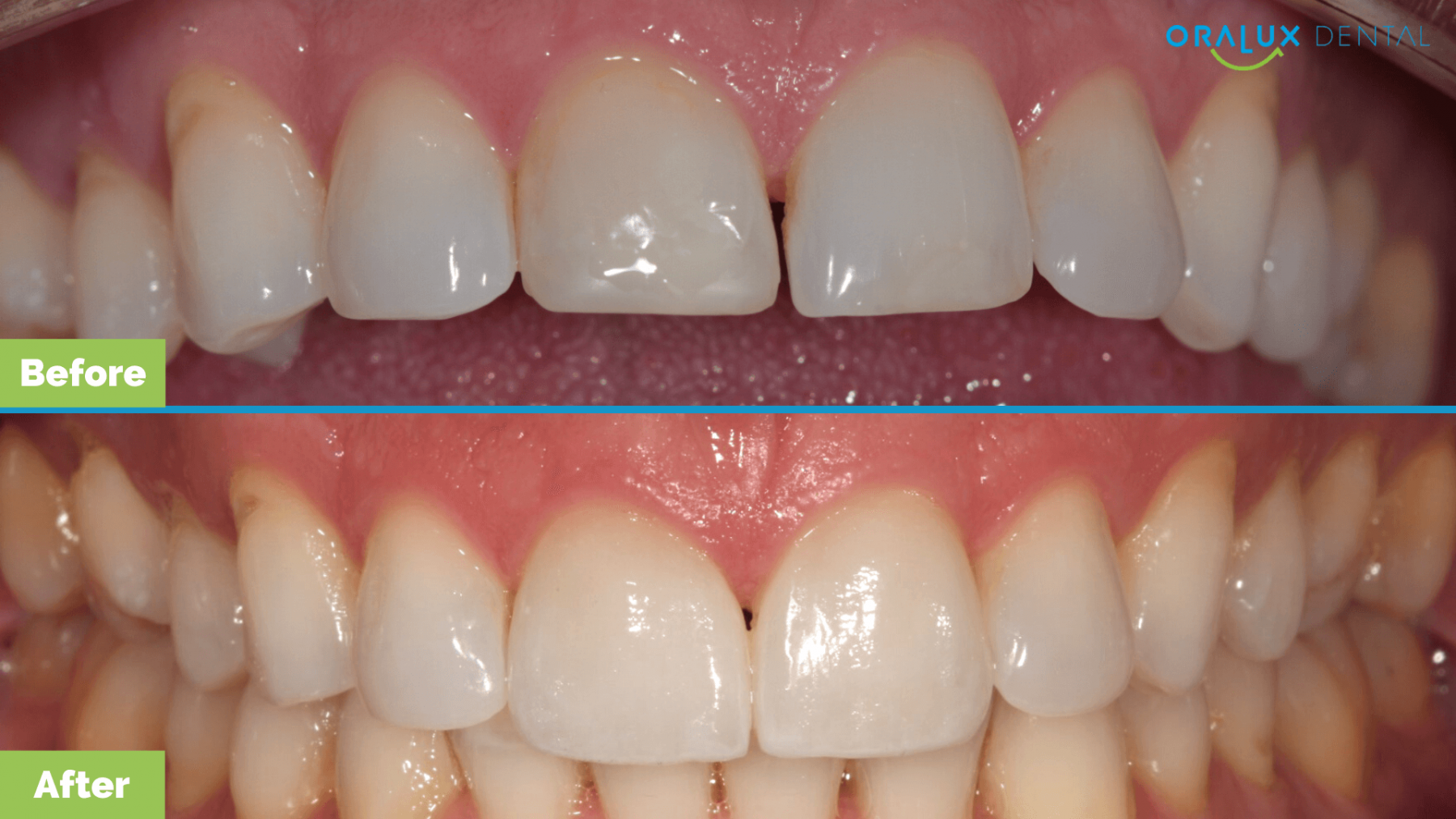 Angus’ Story | Oralux Dental