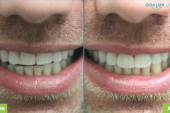 Angus’ Story | Oralux Dental