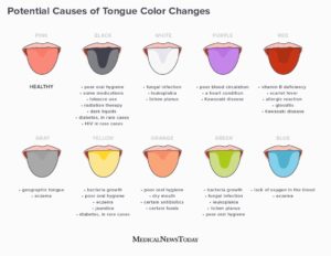 What Do Different Tongue Color Mean? | Oralux Dental